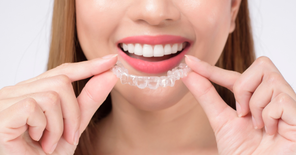 How Does Invisalign® Work? - Perfect Dental